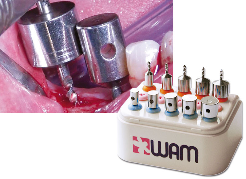 MD Guide – L'Information Dentaire