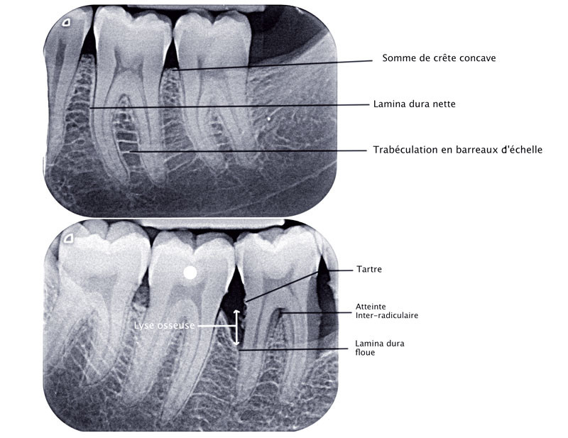 Evolution de l’imagerie en parodontologie – L'Information Dentaire