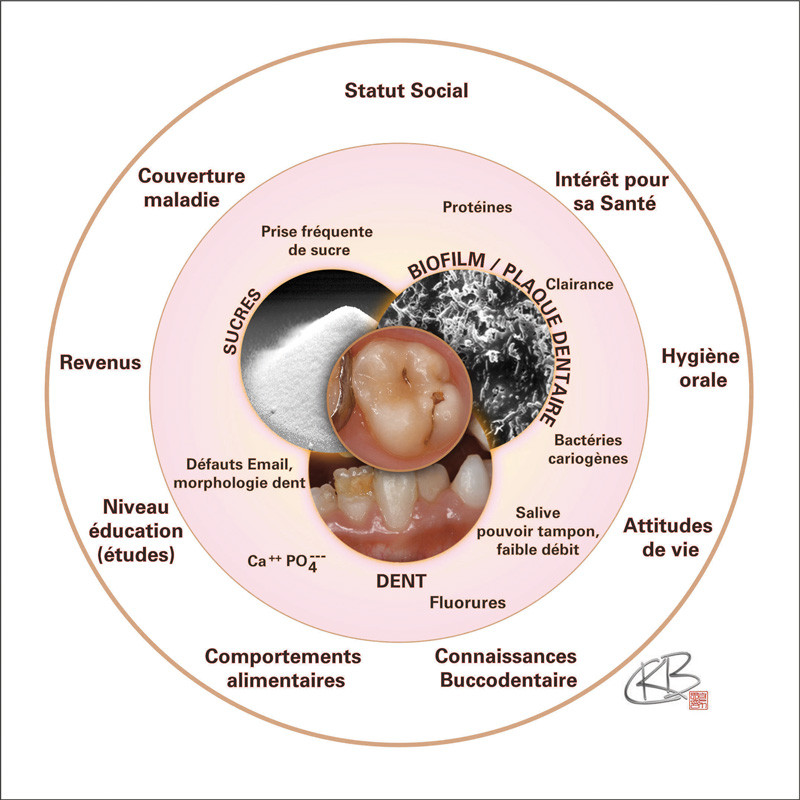 Comprendre les bases de la cariologie en 10 points (partie 1) – L ...