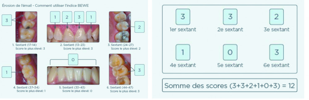 BEWE Assist – L'Information Dentaire