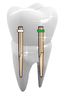 Peek Optima – L'Information Dentaire