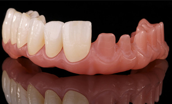 Zirkonzahn : L’artisanat et le digital – L'Information Dentaire