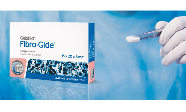 Fibro-Gide – L'Information Dentaire