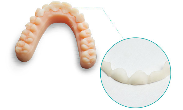 Smilers Fix – L'Information Dentaire
