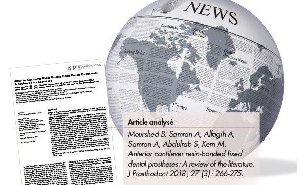 Bridge collé en extension – L'Information Dentaire