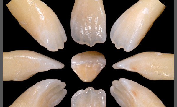 La nature profonde de l’incisive centrale maxillaire – L'Information ...