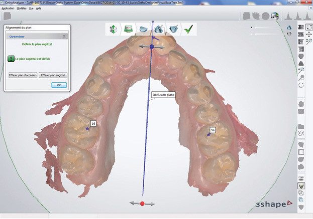 L’orthodontie numérique au quotidien – L'Information Dentaire