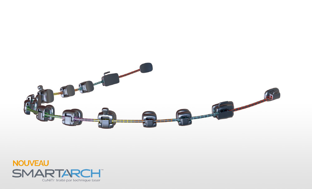 Ormco – Le nouveau SmartArch™ d’Ormco : moins de séquences d’arcs, une force idéale sur chaque ...