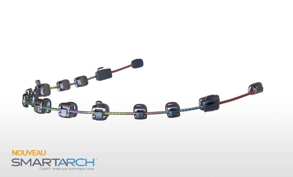 Ormco – Le nouveau SmartArch™ d’Ormco : moins de séquences d’arcs, une force idéale sur chaque ...