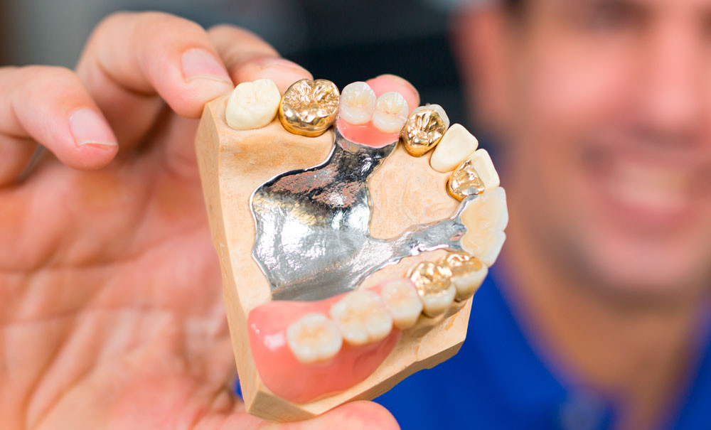 Mon prothésiste reçoit mes patients – L'Information Dentaire