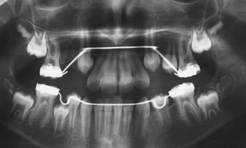 Le parodonte sain – L'Information Dentaire