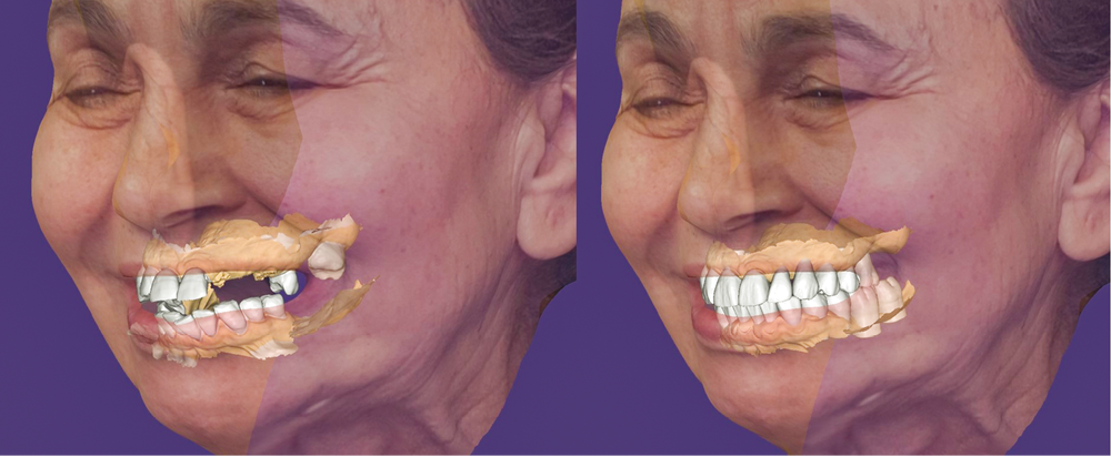 Flux numérique complet au service de la mise en charge immédiate dans ...