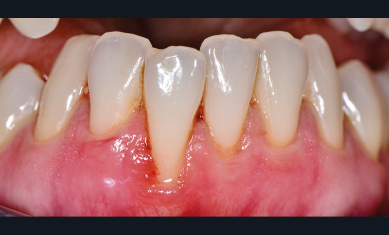 Relations ortho-paro : optimiser et faciliter le flux des données – L ...