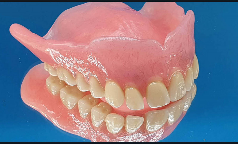 La réfection des bases en résine en prothèse amovible – L'Information ...