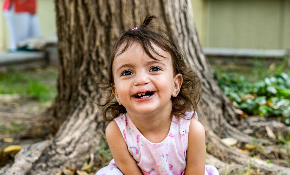 Fentes labio-palatines – L'Information Dentaire