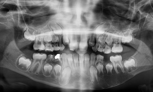 Le parodonte sain – L'Information Dentaire