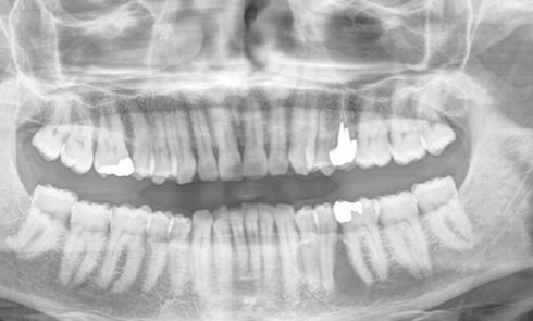 Le parodonte sain – L'Information Dentaire