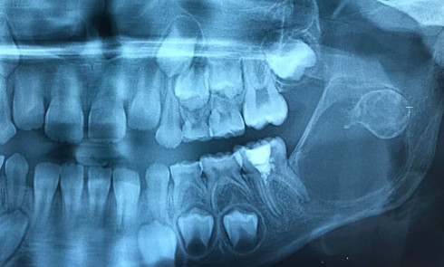 Le parodonte sain – L'Information Dentaire