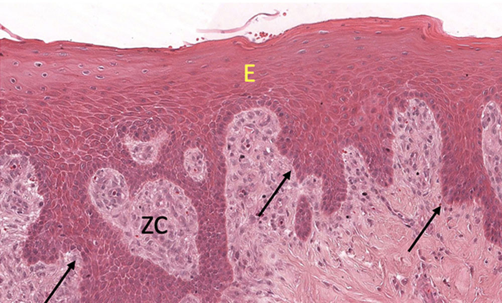 Cicatrisation de la muqueuse orale : études cliniques et expérimentales ...