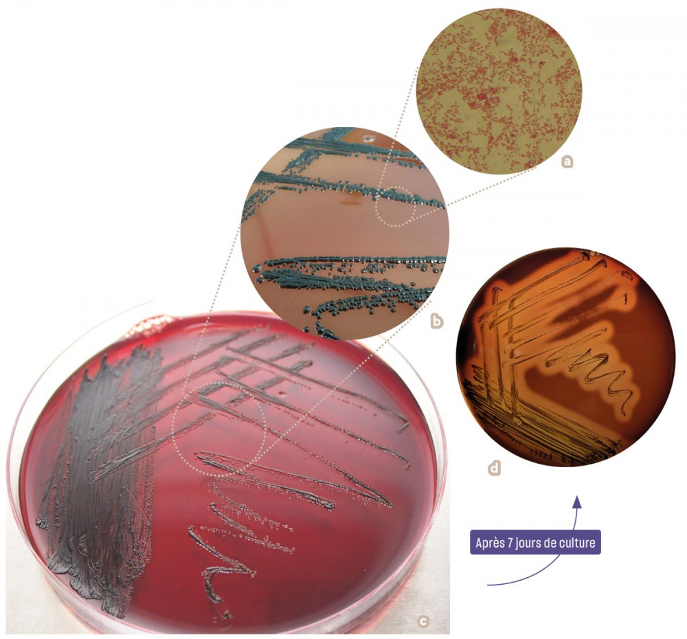 Porphyromonas gingivalis – L'Information Dentaire