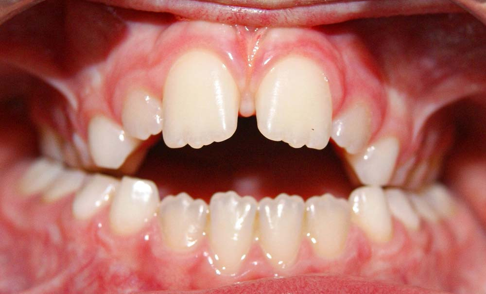 Adapter sa stratégie thérapeutique aux caractéristiques de l ...