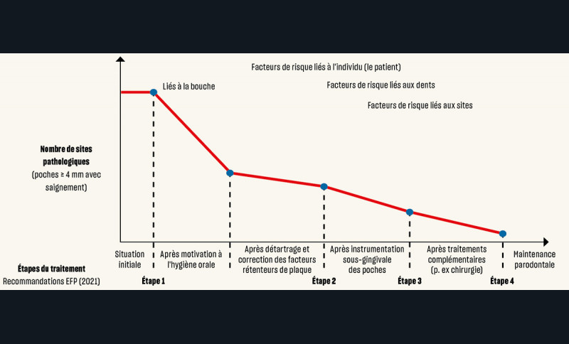 Traitement chirurgical des poches parodontales résiduelles Pourquoi ...