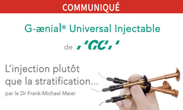 L’injection plutôt que la stratification : comment un composite est ...