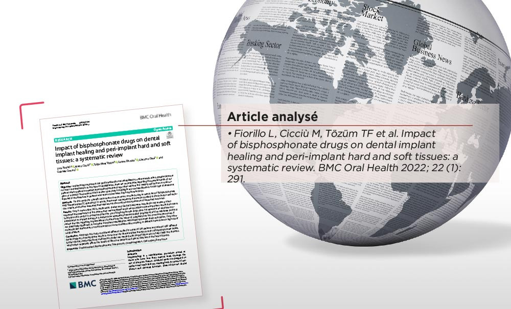 Impact des bisphosphonates sur les traitements implantaires – L ...