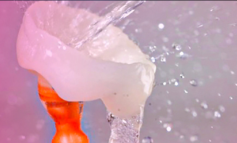 Post-etching cleaning, indispensable ou superflu ? – L'Information Dentaire