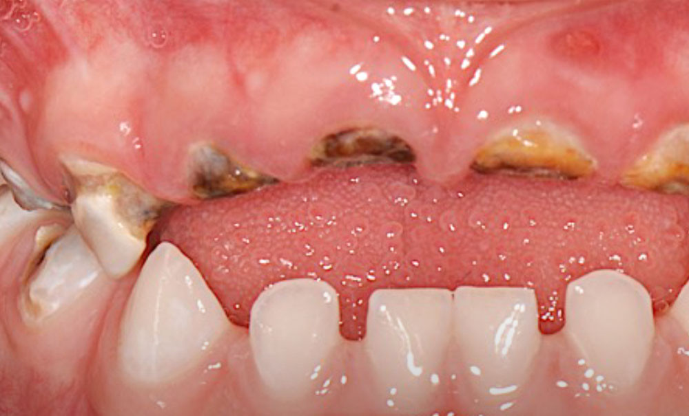 Carie de la petite enfance, le rôle de l’alimentation – L'Information ...