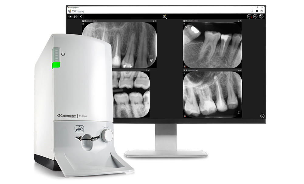 L’édition Neo du CS 7200, de Carestream Dental – L'Information Dentaire