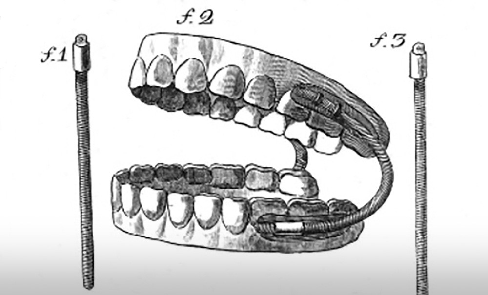 Les innovations de Jean-Baptiste Gariot – L'Information Dentaire