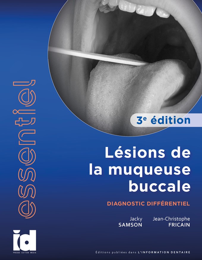 ESSENTIEL – Lésions de la muqueuse buccaleDiagnostic différentiel3e ...