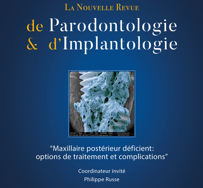 NRPI – Maxillaire postérieur déficient : options de traitement et ...