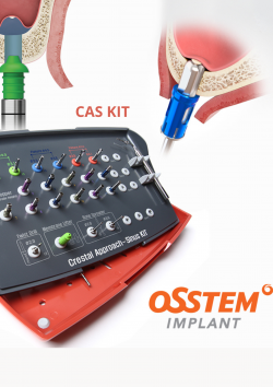 Le CAS-KIT d’Osstem tout en délicatesse – L'Information Dentaire
