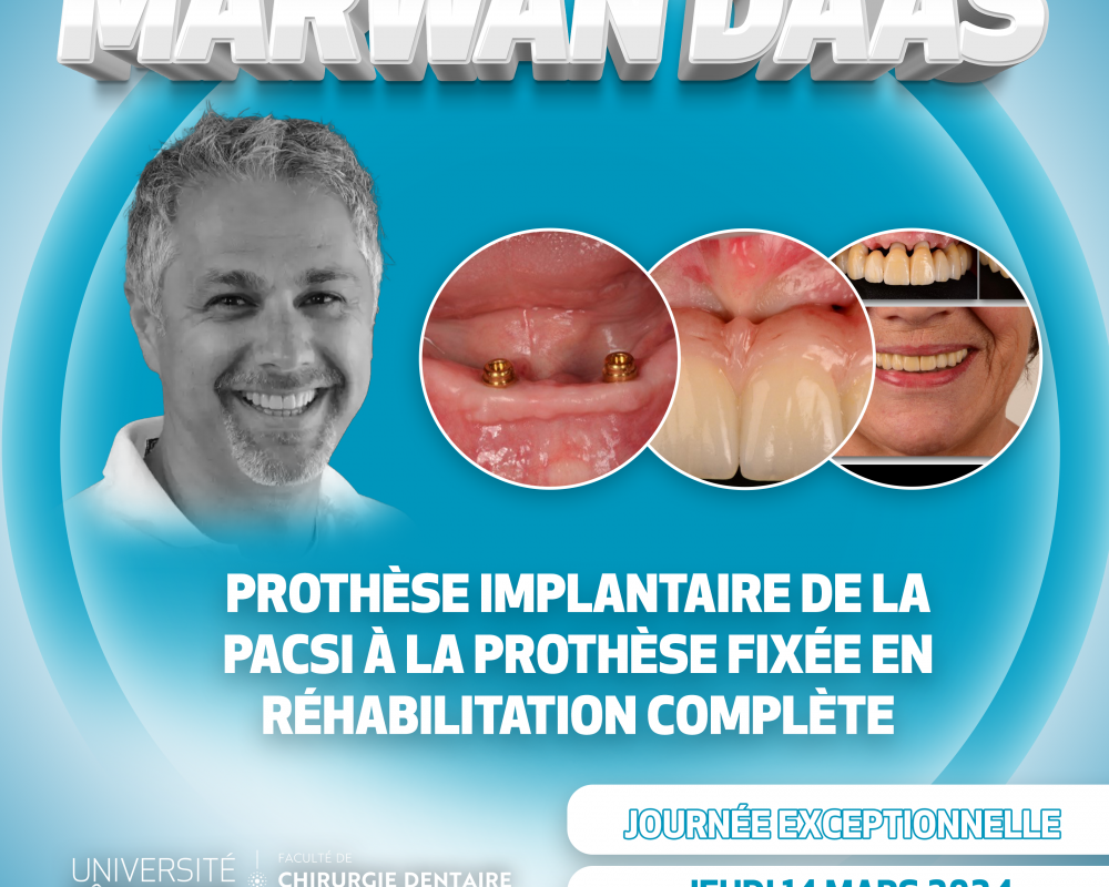 Prothèse implantaire de la Pacsi à la prothèse fixée en réhabilitation ...