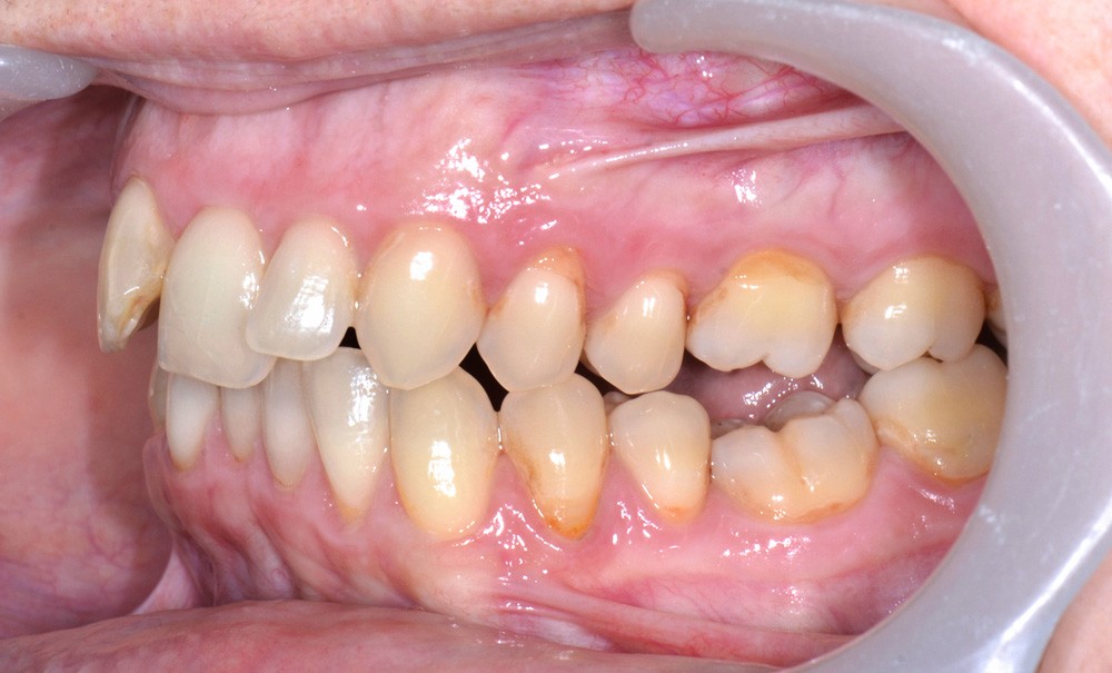 Postcongrès – Focus sur le pré-cours. La réévaluation thérapeutique ...