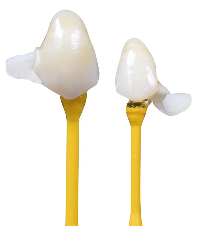 Le bridge collé canin en vitrocéramique : on adhère ! – L'Information ...